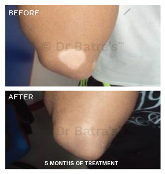 Dr Batra’s™ Homeopathic Treatment UAE | Homeopathic Remedies Online